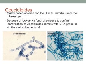 Coccidioides - Fungal Infections - AntiinfectiveMeds.com