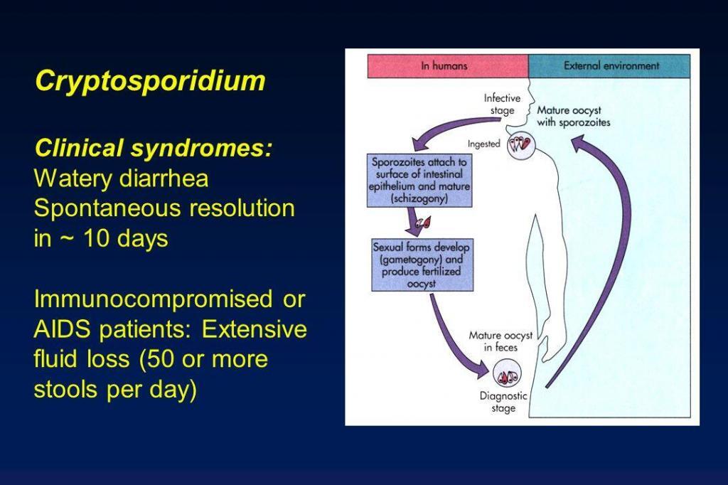 Cryptosporidium: Clinical Syndromes - Parasitic Infections ...