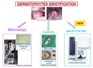Dermatophytes - Fungal Infections - AntiinfectiveMeds.com