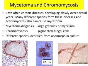 Chromomycosis - Fungal Infections - AntiinfectiveMeds.com