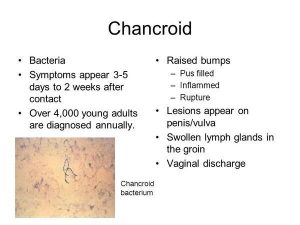 Chancroid. Medical Symptoms and Signs of Chancroid - Sexually ...