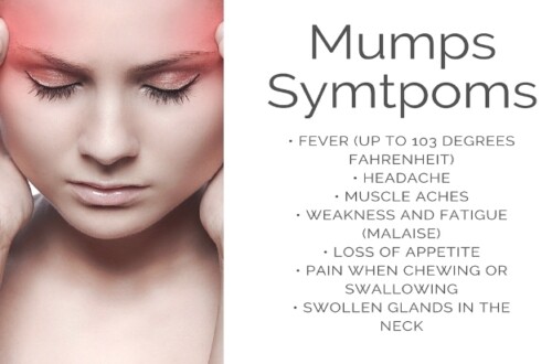 Mumps - Viral Infections - AntiinfectiveMeds.com